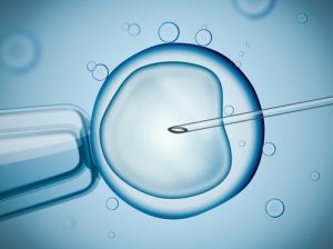 At least 85 mass donors implicated in fertility clinic scandal ...